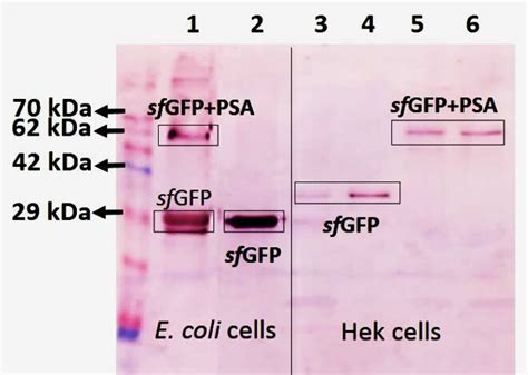 Expression Of Sfgfp Psa Fusion Protein In Hek 293t Cells Detection Of