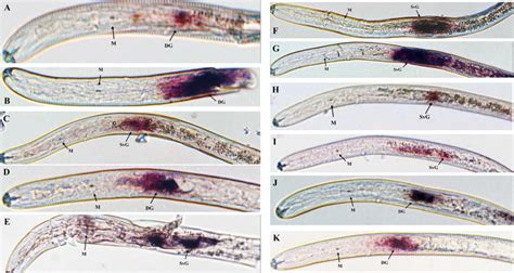 In Situ Hybridization Of Digoxigenin Labeled Antisense Dna Probes Dark