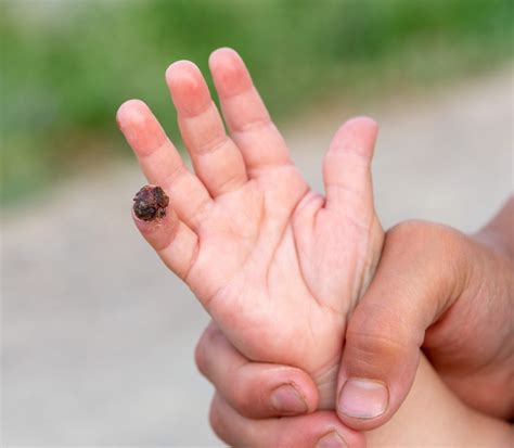 Diy Vs Professional Pest Control Expert Insight And Guidance