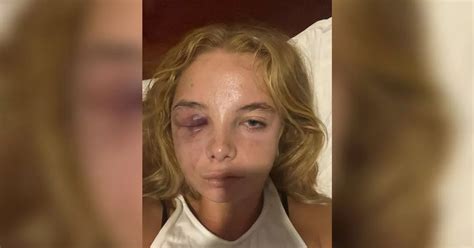 Get Off Me Teacher Left With Horrific Injuries After Being Brutally