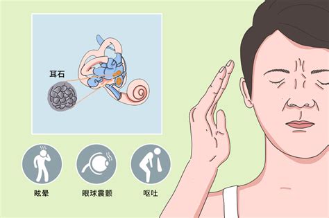耳石症是脑梗的前兆吗 有来医生