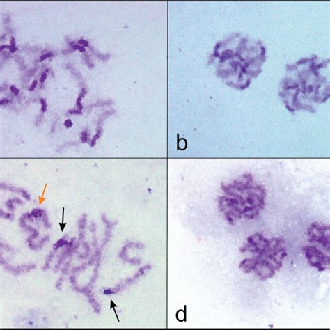 Abn Bozdagus With Dark Heterochromatic Blocks On All Chromosomes A