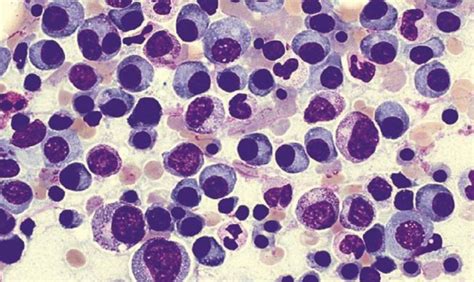 Células T Tipos De Celulas