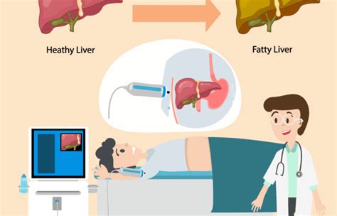Fibroscan Dr Varun