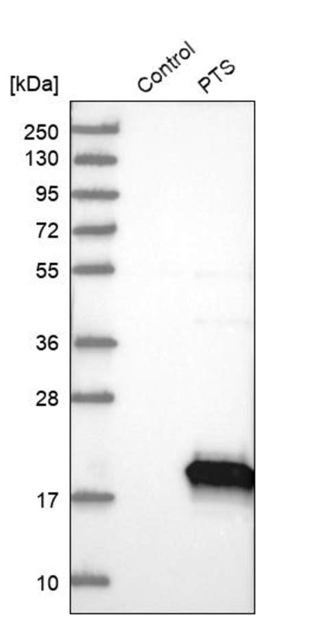 ANTI PTS HPA001481 25UL SIGMA ALDRICH SLS Ireland