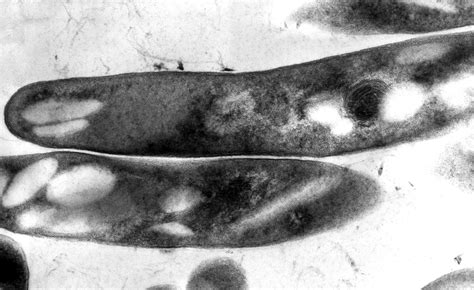 Free Picture Gram Positive Mycobacteria Tuberculosis Bacilli