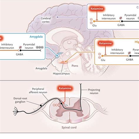 Pdf General Anesthesia Sleep And Coma