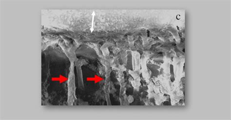 Study Explores Impact Of Universal Adhesive Viscosity On Dentin Bond