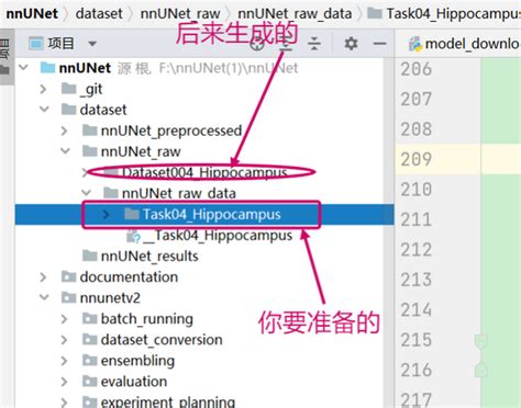 Nnunet V2训练自己的数据集 知乎