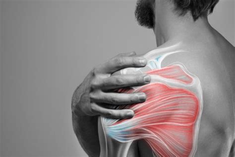 Brachial Plexus Surgery And Cost In India Expert Surgeons