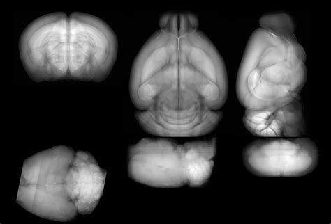 Checking Orientation — Brainglobe