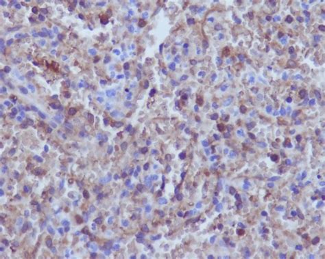 Hemoglobin Subunit Alpha Rabbit Mab Wb Ihc P Fc Ip Buy Now