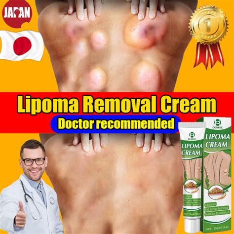 Ouhoe Lipoma Removal Cream Original 20g Herbal Lipoma Removal Cream