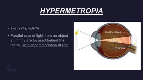 Hypermetropia Basics Of Hypermetropia Ppt Free Download