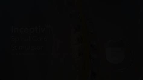 [video] Mike Sledd On Linkedin Medtronicemployee