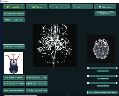 example of the graphical user interface of the segmath segmentation