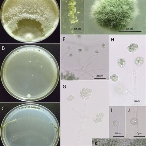 Morphological Characteristics Of Trichoderma Texanum A C Cultures On Download Scientific