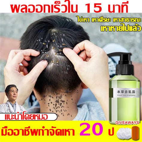 แชมพูกำจัดเหา แถมฟรี‼ สูตรสมุนไพร ยาฆ่าเหา เหาตาย ไข่เหาฝ่อ กำจัดเหาและ