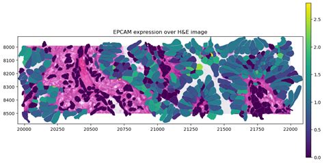 Technology Focus Xenium — Spatialdata