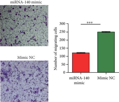 Overexpression Of MiRNA 140 Inhibited The Migration And Invasion Of HCC