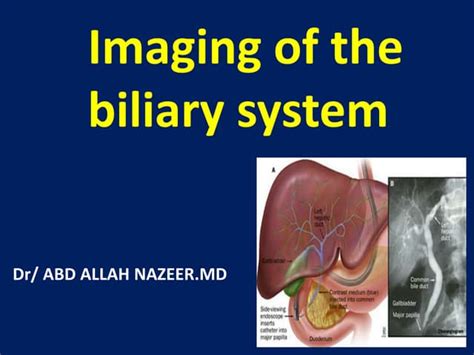 Presentation2 Pptx Imaging Of The Biliary System Ppt