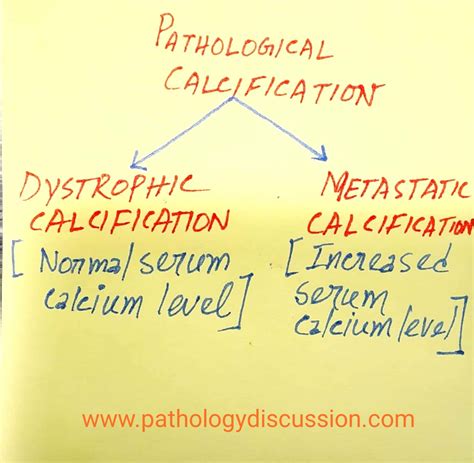 Faq On Pathologic Calcification Dystrophic Calcification Metastatic Calcification Psammoma Body