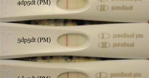Ivf Fet Pregnancy Calculator Lyallkendyll