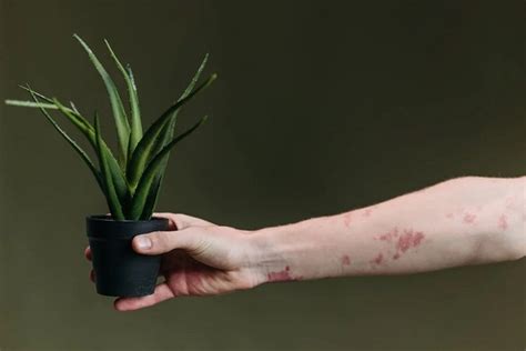 A Teens Guide To Creating A Sensitive Skin Routine To Manage Eczema