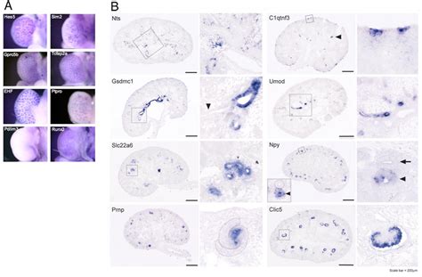In Situ Hybridization Validation Of Microarray Results Download