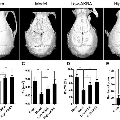 Akba Treatment Attenuated Titanium Particle Induced Bone Loss And