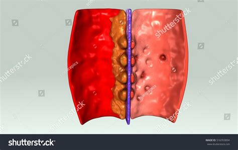 Glomerulus Stock Illustrations Images And Vectors Shutterstock