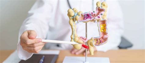 Do You Need A Colon Screening How A Fit Can Help