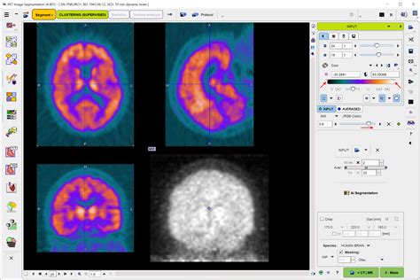 PSEG Workflow CLUSTER ANALYSIS SUPERVISED Image Loading