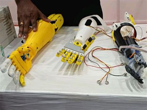 Visali Venkatesan On Linkedin Biomedicalengineering Innovation