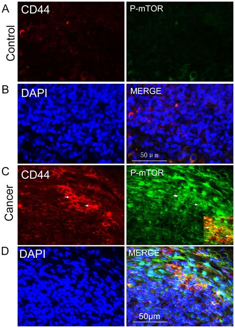 Downregulation Of Cancer Stem Cell Properties Via Mtor Signaling