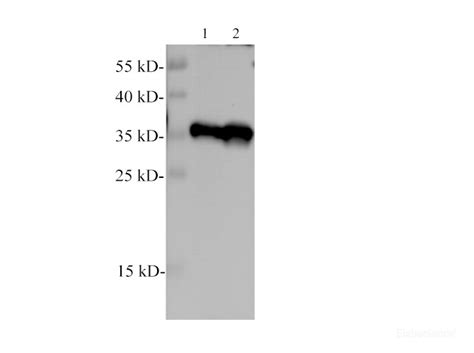 High Affinity And Specificity Pcna Polyclonal Antibody E Ab 40514 At