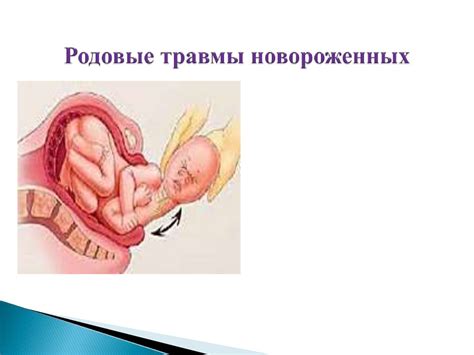 Родовые травмы новороженных - презентация онлайн
