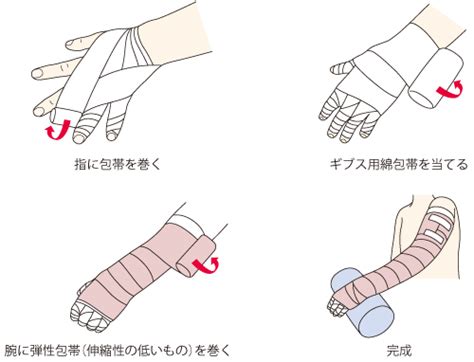 リンパ浮腫のリハビリテーション Kompas 慶應義塾大学病院 医療・健康情報サイト