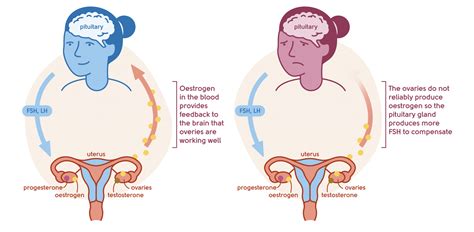 Menopause Symptoms Headaches And Migraines My Menopause Centre