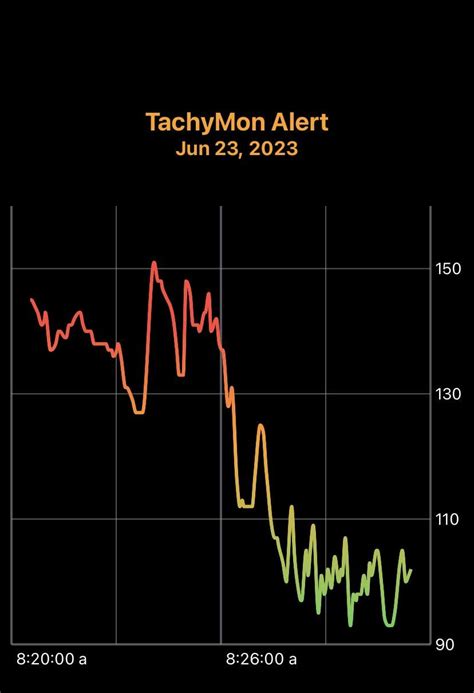 Pots Heart Rate Graphs R Pots