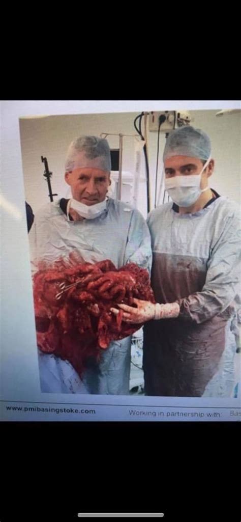 Climax Of Surgery Dr Umer Abid