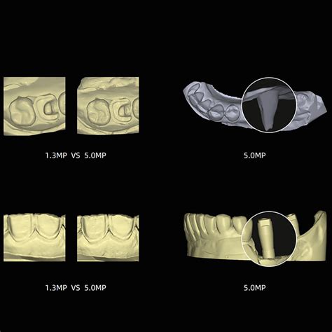 New Benchtop 3d Dental Scanner Manufacturer