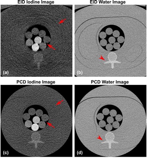 Examples Of Iodine A C And Water Specific Images B D Download Scientific Diagram
