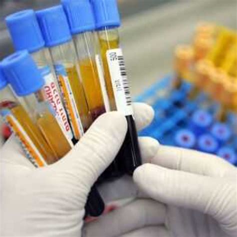 Stream Understanding The Hba1c Test And Its Importance A Guide For