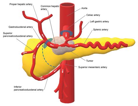 Celiac Artery