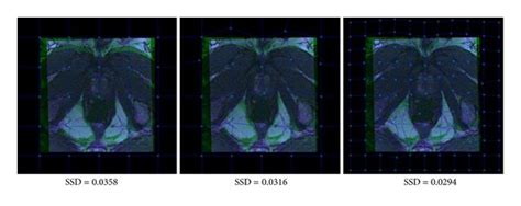 Registration Results Of Manual Revision Of Affine Ffd And Demons For Download Scientific