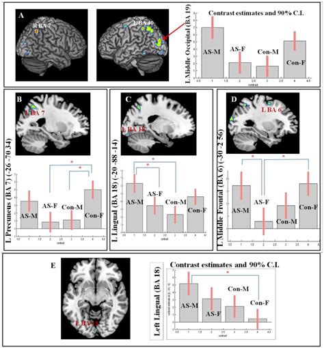 A Left And Middle Interaction Effect On Left Middle Occipital Gyrus