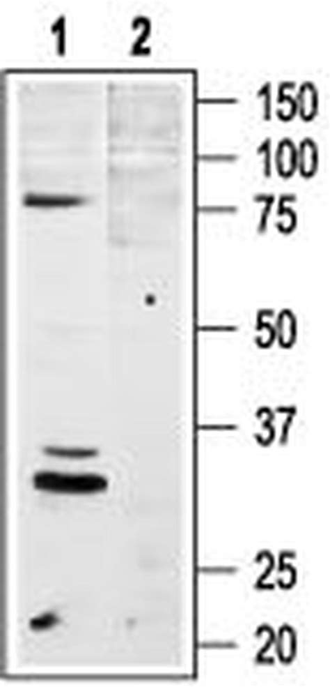 Mc4 Receptor Extracellular Polyclonal Antibody Amr 024 200ul