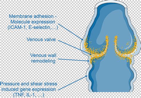 Varicose Vein Vector