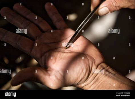 Mercury Poisoning Illegal Gold Mining Effects Lombok Indonesia Asia